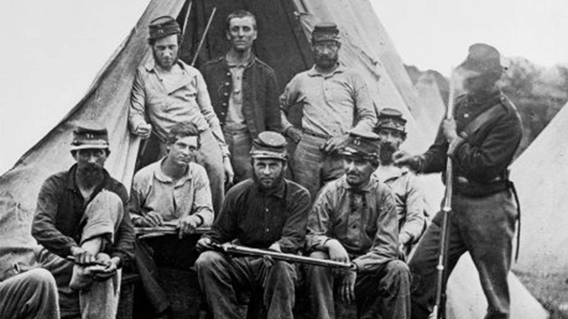 Civil War Burns